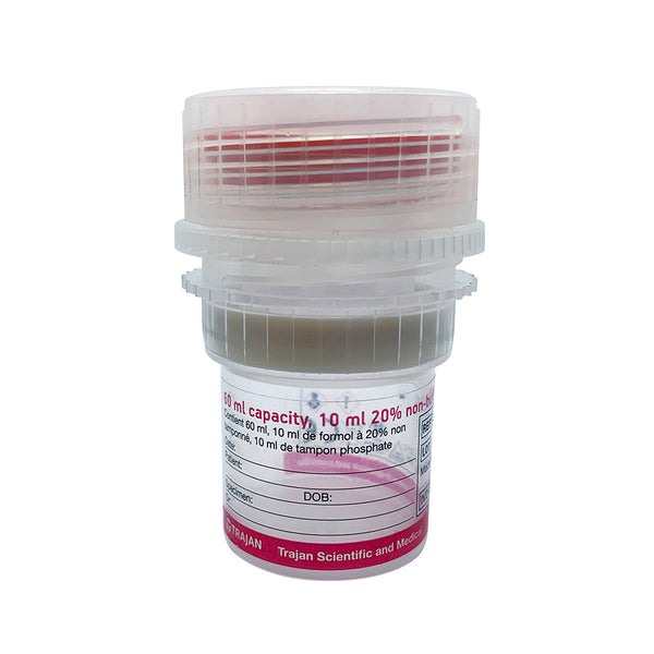 Prefilled NBF Containers - Trajan Scientific and Medical